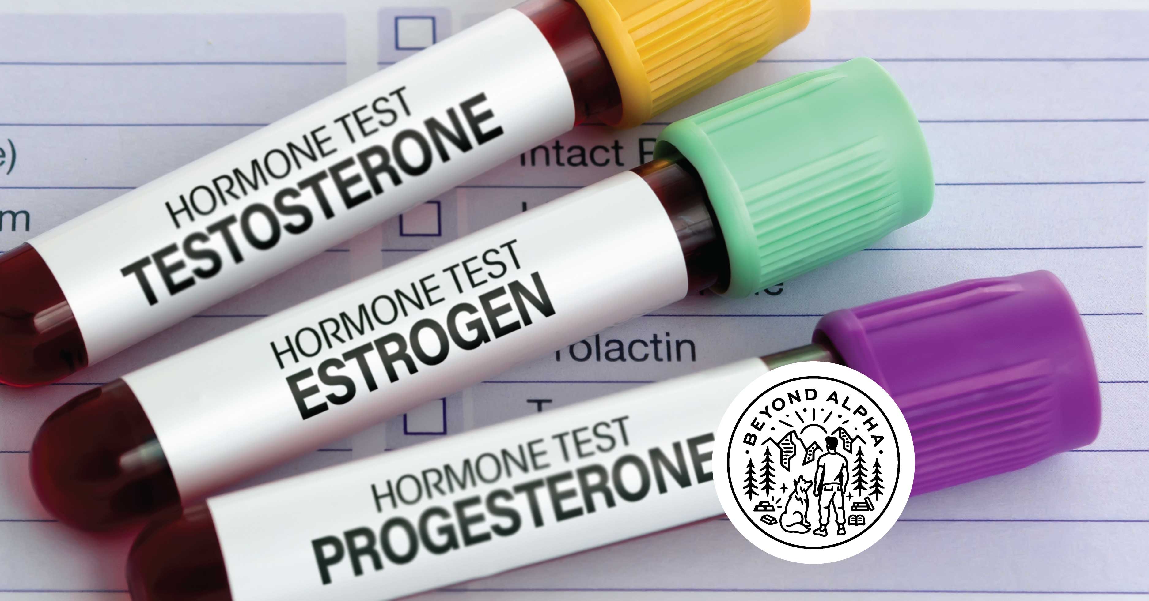 Do Men Have Estrogen? Here’s Why It Matters More Than You Think – Beyond Alpha